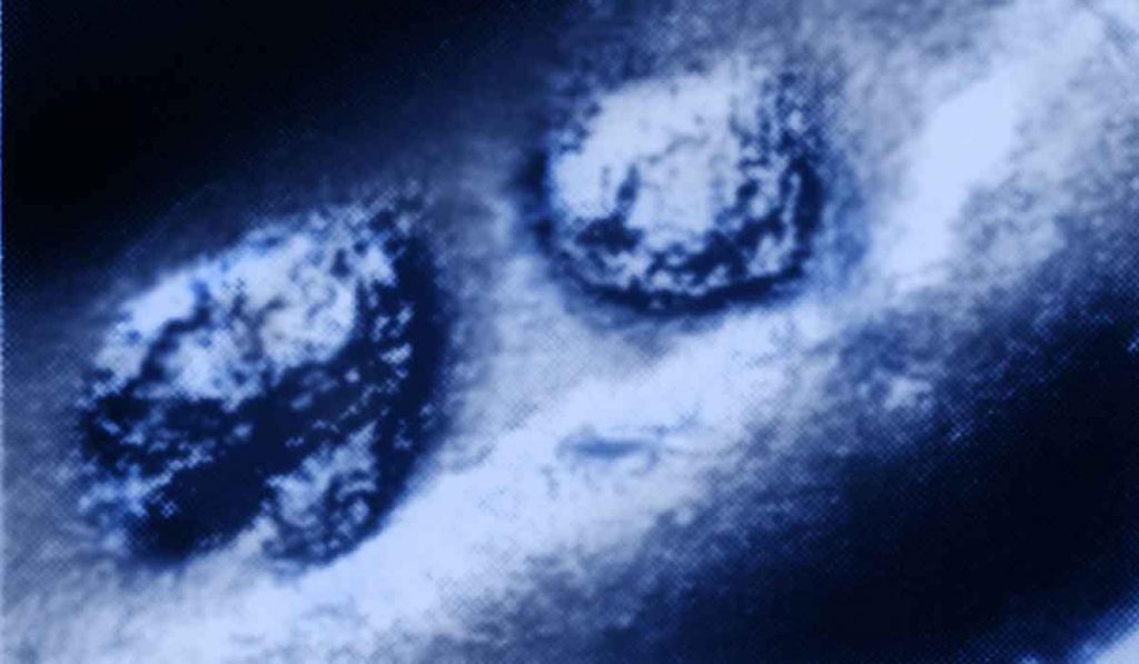 Common Defects in Lost Wax Jewelry Casting / 6 typical types of casting ...