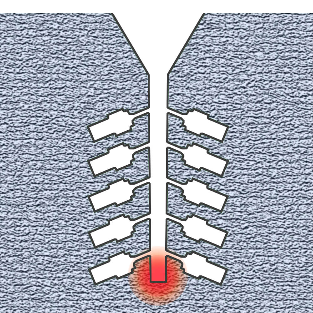 SPRUE SYSTEM for better results in JEWELRY CASTING / “HOTSPOTS” where ...